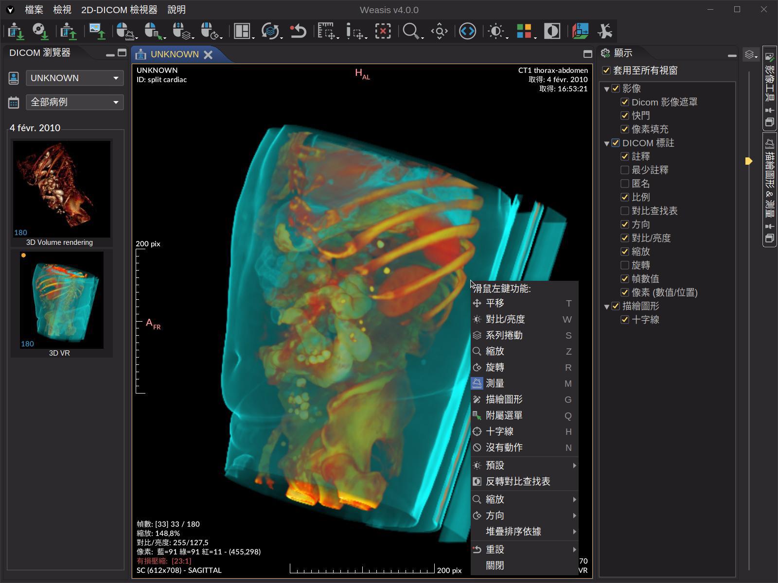 Weasis: Free DICOM viewer :: Weasis Documentation